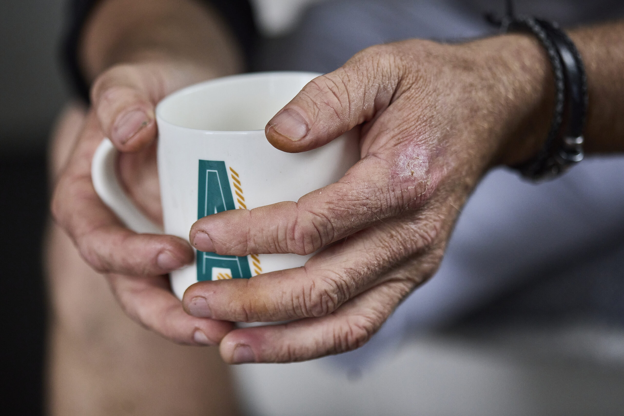 Support - Bridge Housing